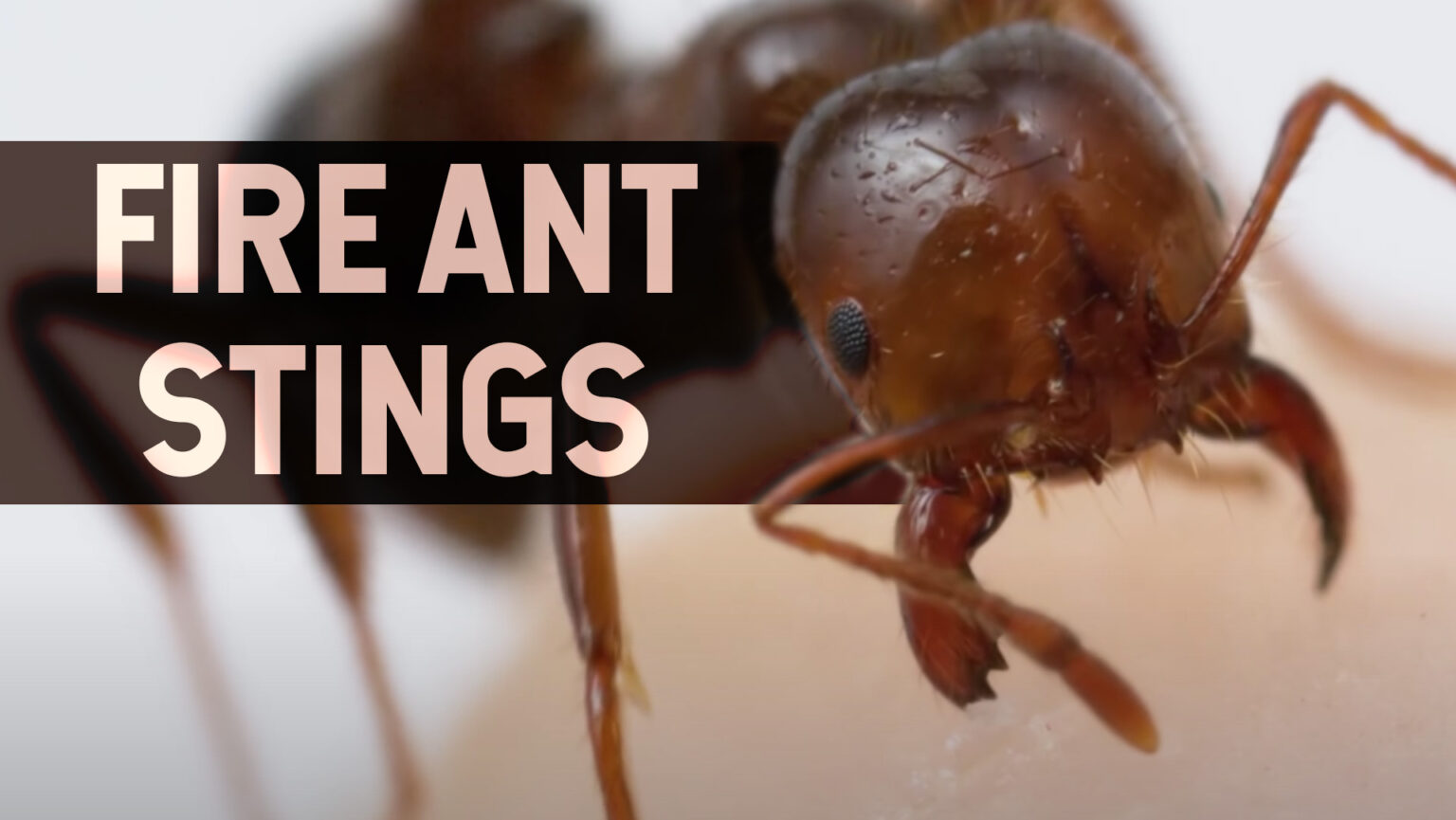 fire ant stings - Untamed Science